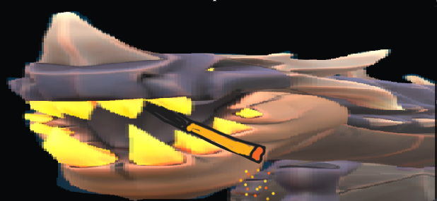 ELDERFLAME JUDGE (pt2) - VALORANT